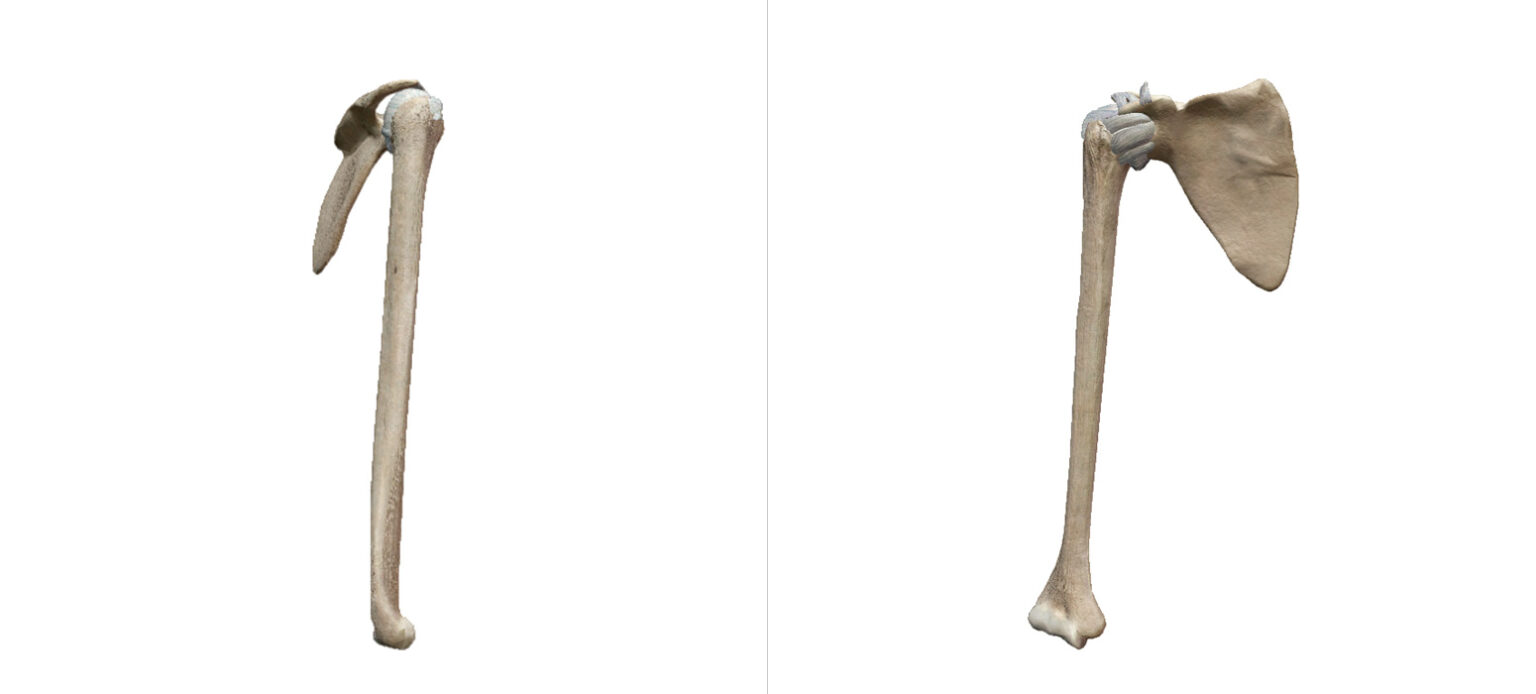 Fracture de l'humérus à Paris | Institut de Kinésithérapie